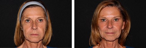 Gallery – Christopher Jones MD