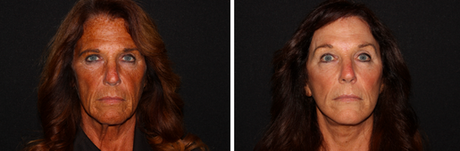 Gallery – Christopher Jones MD